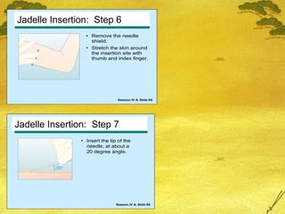 Implants.ppt3