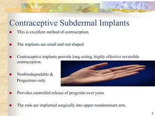 Subdermal Implant Birth Control