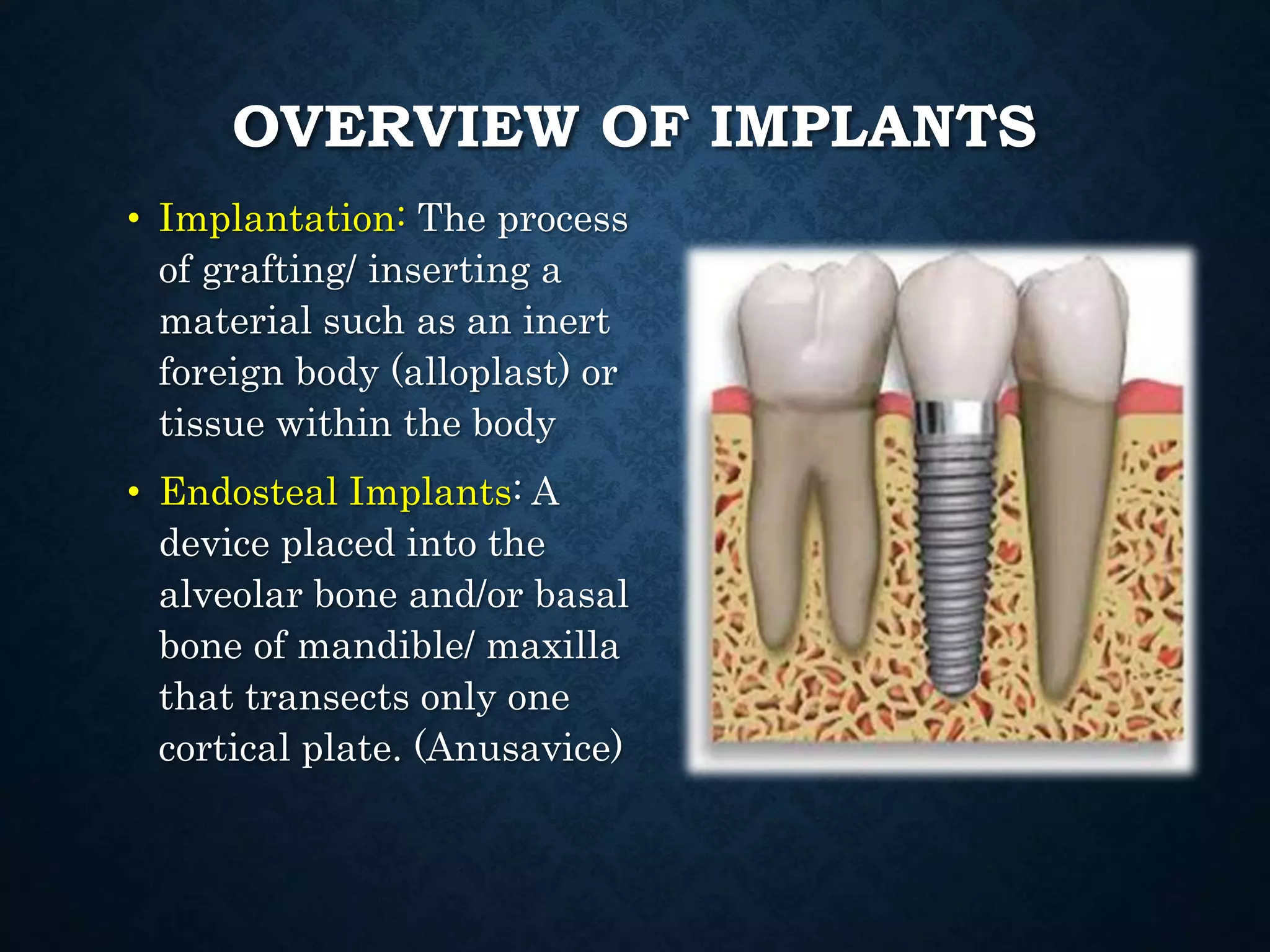 Implants : An Overview, Biomechanics & Treatment Planning | PPTX