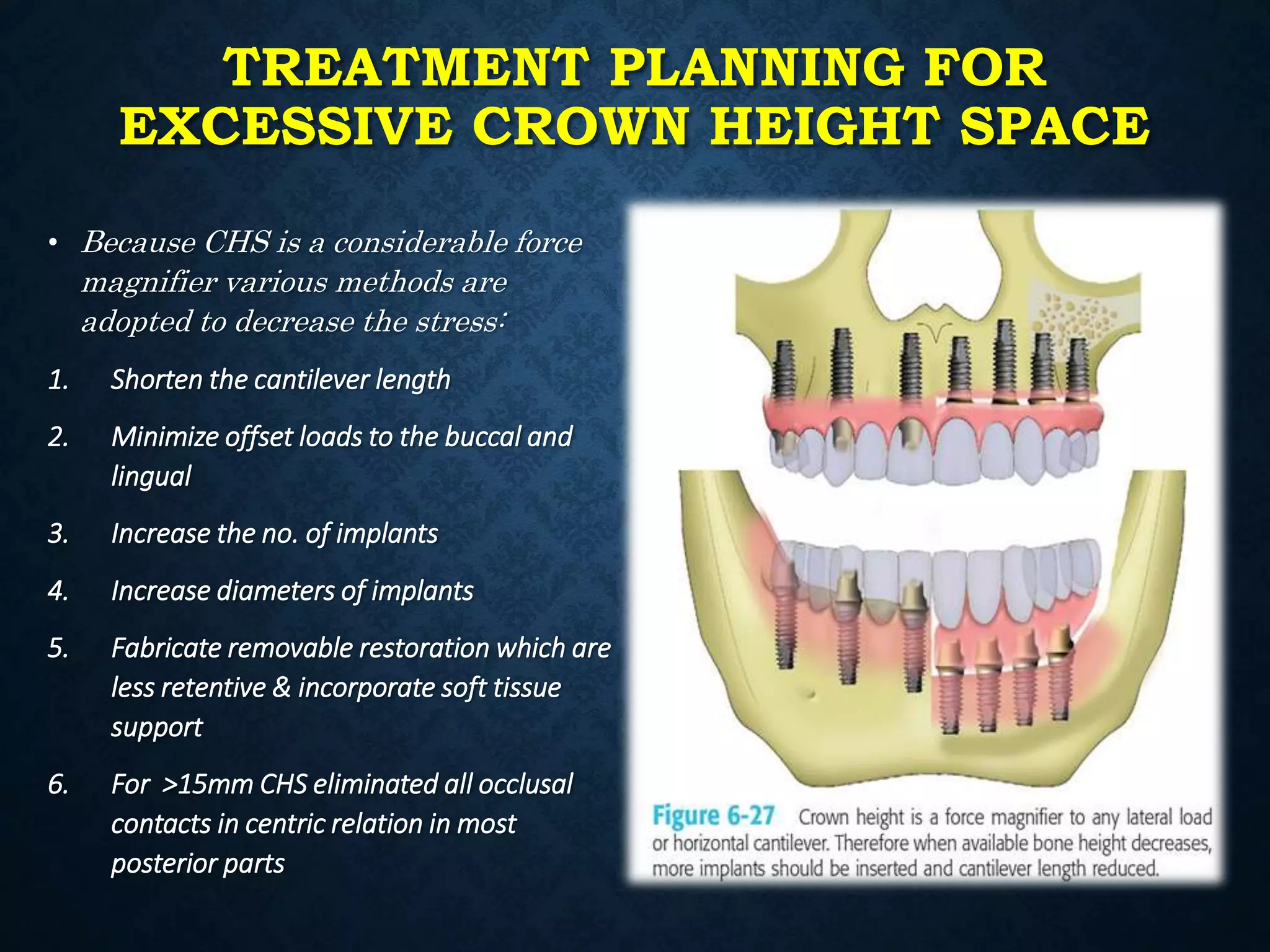 Implants : An Overview, Biomechanics & Treatment Planning | PPTX
