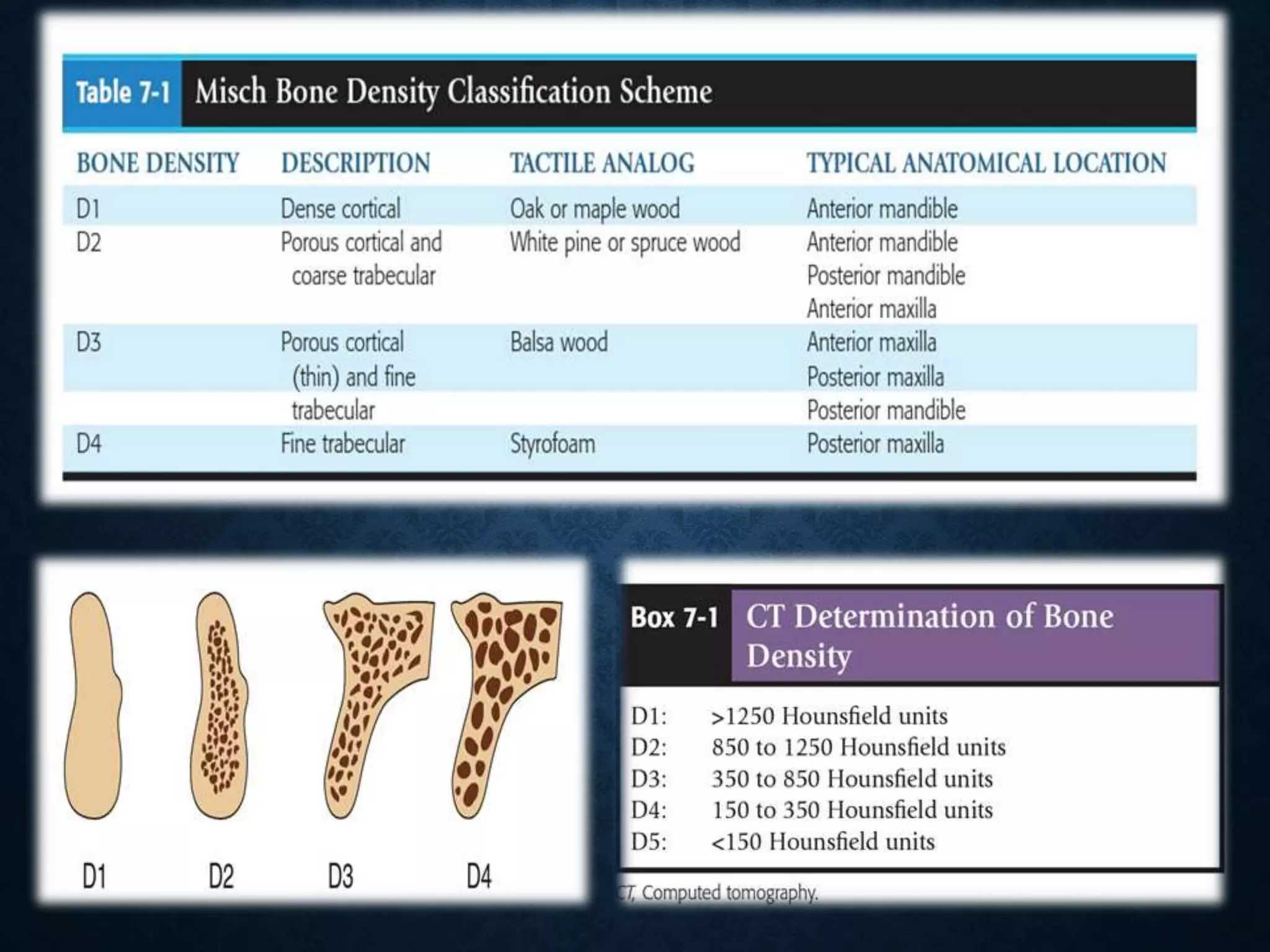 Implants : An Overview, Biomechanics & Treatment Planning | PPTX