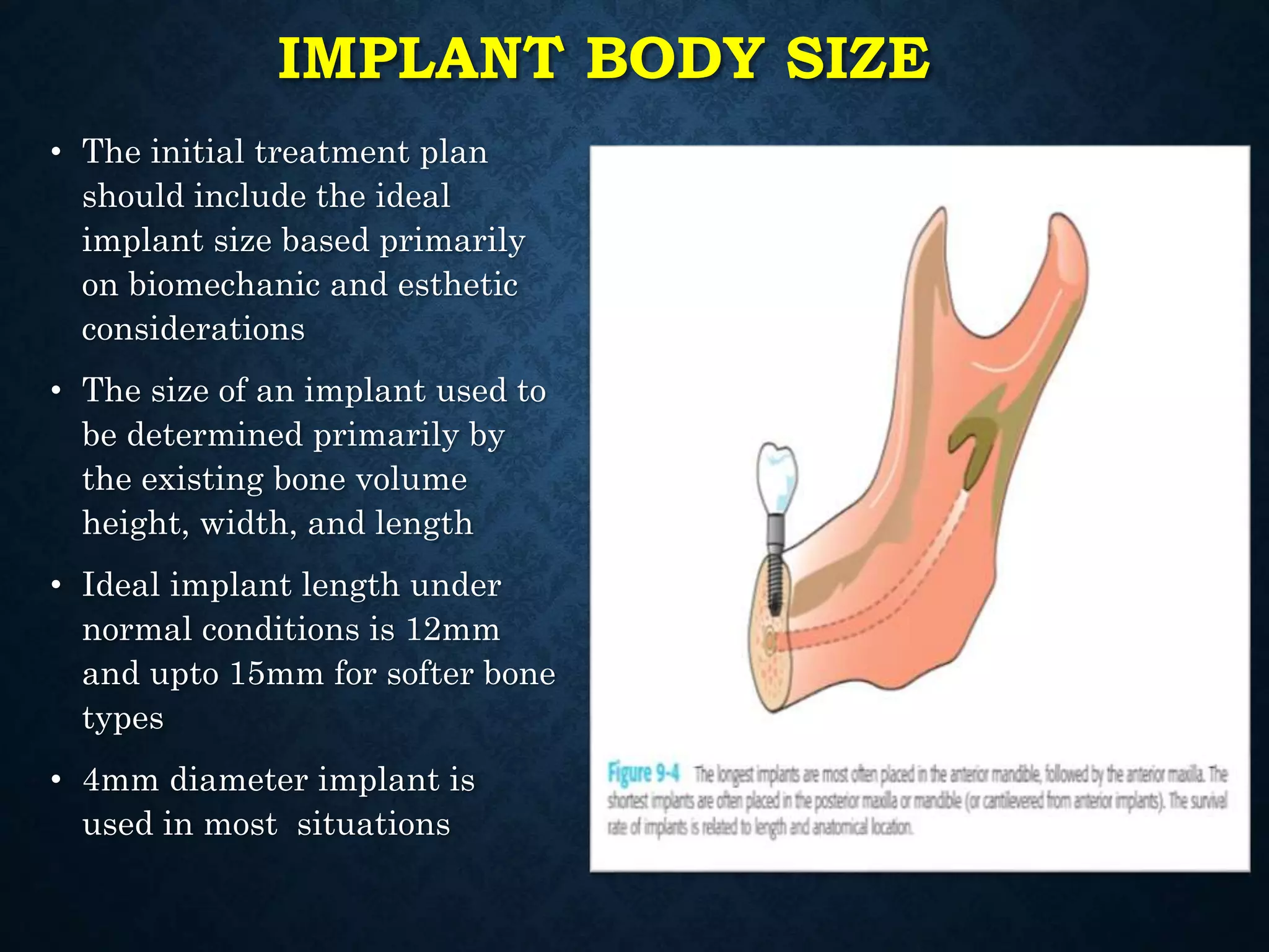 Implants : An Overview, Biomechanics & Treatment Planning | PPTX