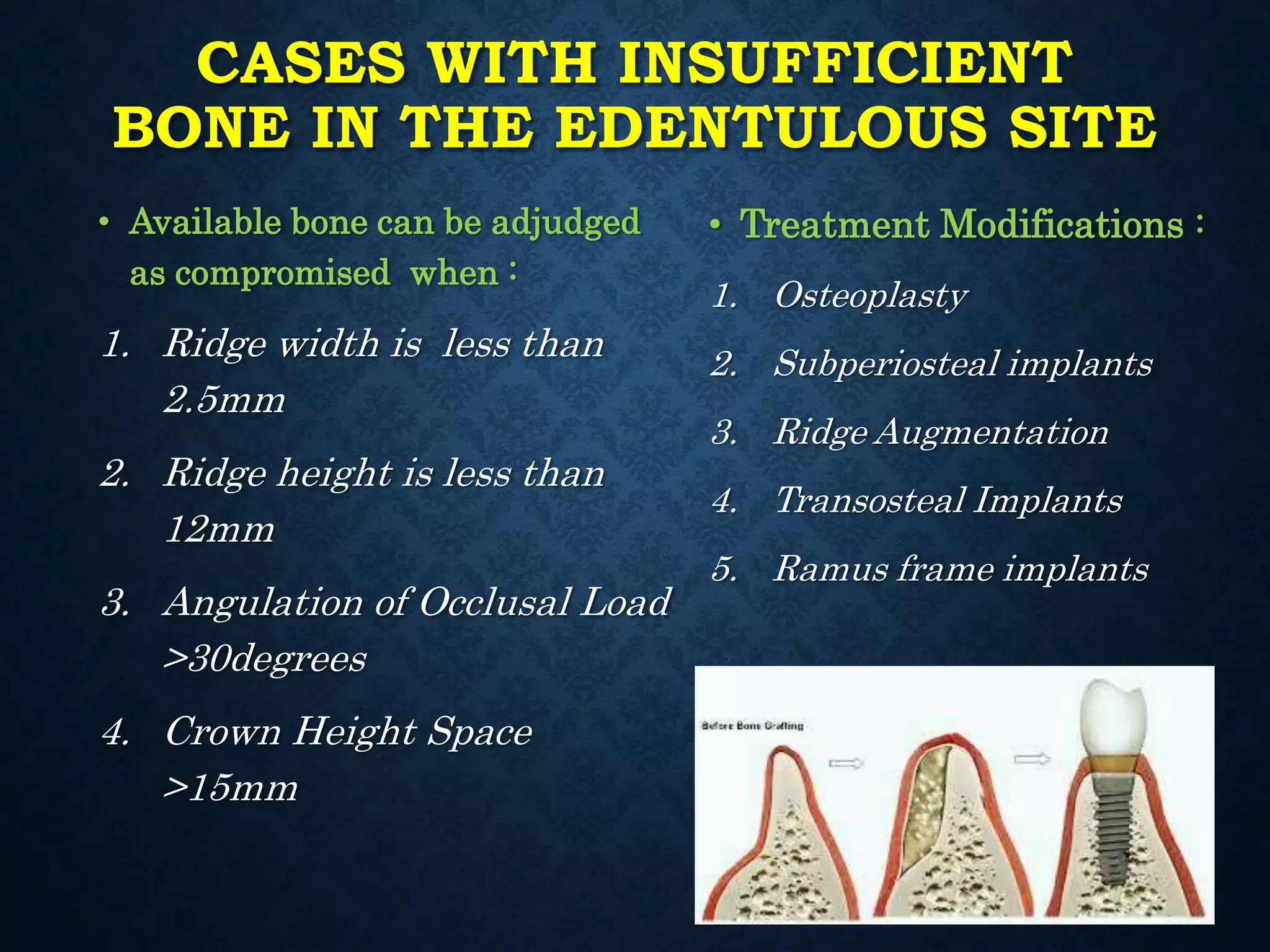 Implants : An Overview, Biomechanics & Treatment Planning | PPTX
