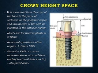 Implants : An Overview, Biomechanics & Treatment Planning | PPTX