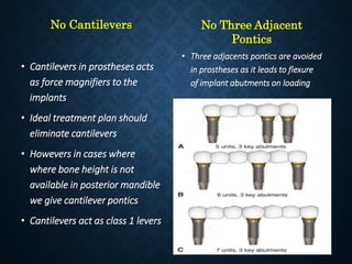 Implants : An Overview, Biomechanics & Treatment Planning | PPTX