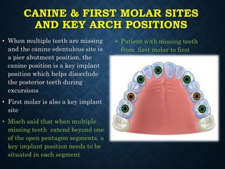 Implants : An Overview, Biomechanics & Treatment Planning | PPTX