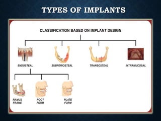 Implants : An Overview, Biomechanics & Treatment Planning | PPTX