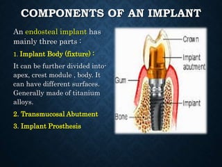 Implants : An Overview, Biomechanics & Treatment Planning | PPTX