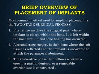 Implants : An Overview, Biomechanics & Treatment Planning | PPTX