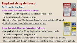 Implants | PPTX
