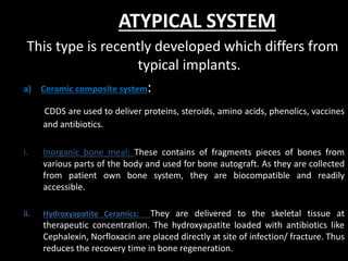 Implants | PPTX