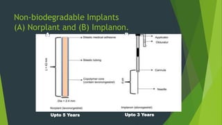 Implants- B.Pharm SEM 7- Novel Drug Delivery System | PPTX