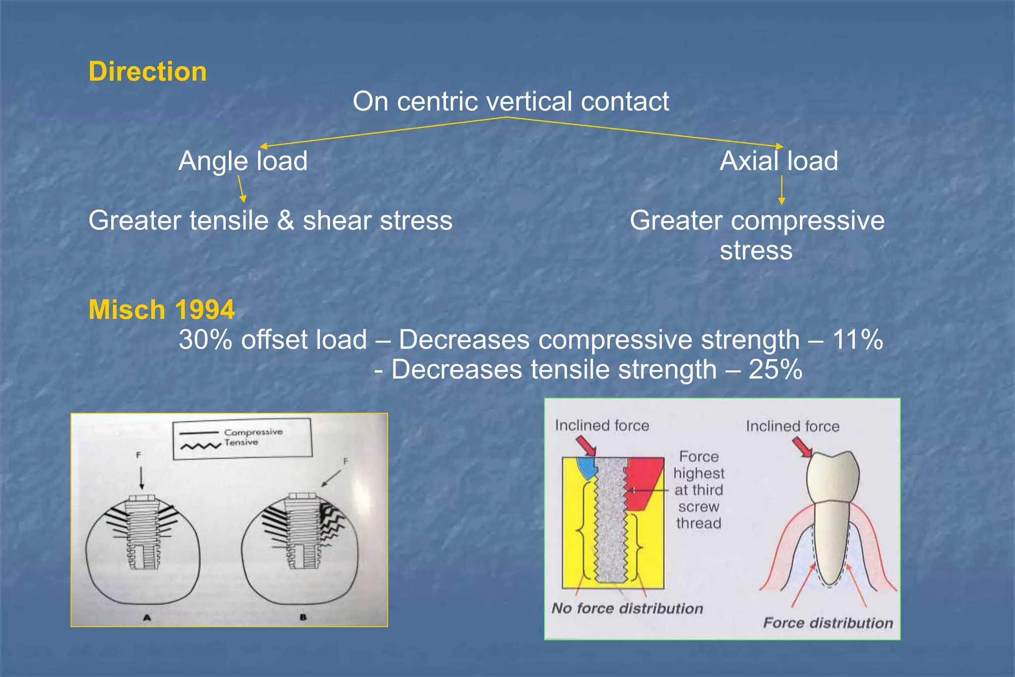 IMPLANTS-Biomechanics.ppt | Bone and Joint Conditions | Diseases and Conditions