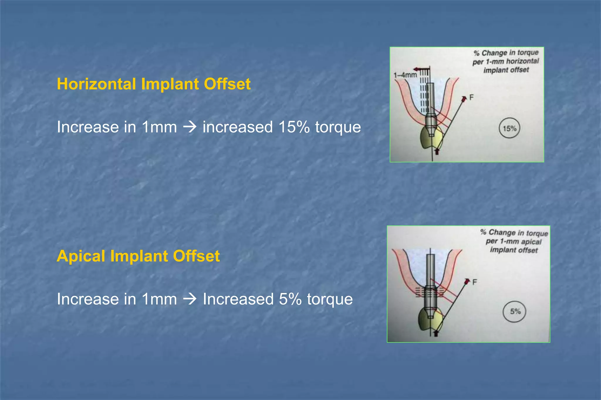 IMPLANTS-Biomechanics.ppt | Bone and Joint Conditions | Diseases and Conditions