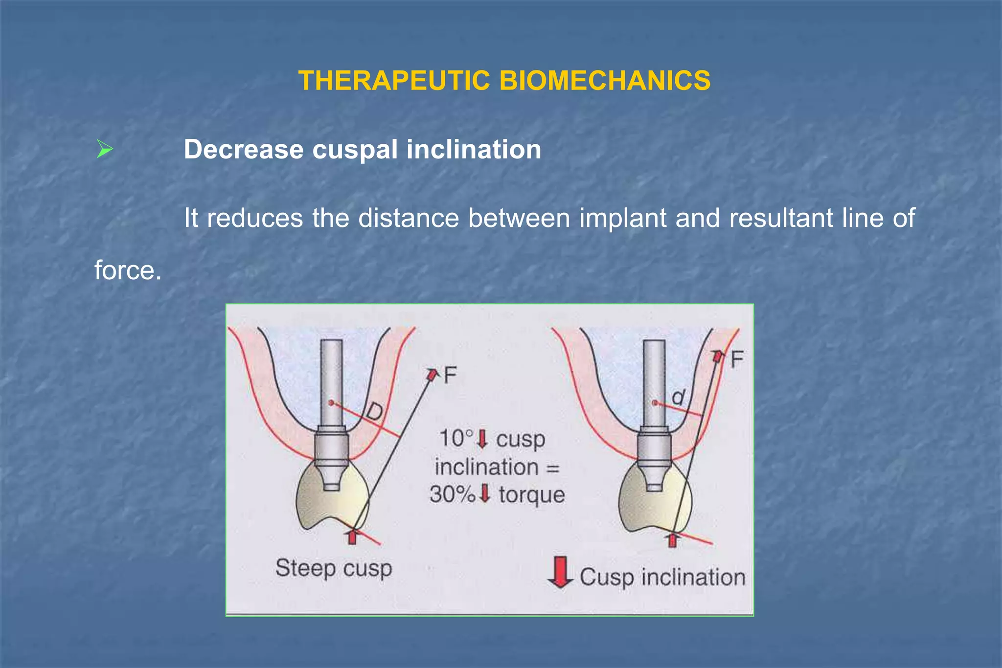 IMPLANTS-Biomechanics.ppt | Bone and Joint Conditions | Diseases and Conditions