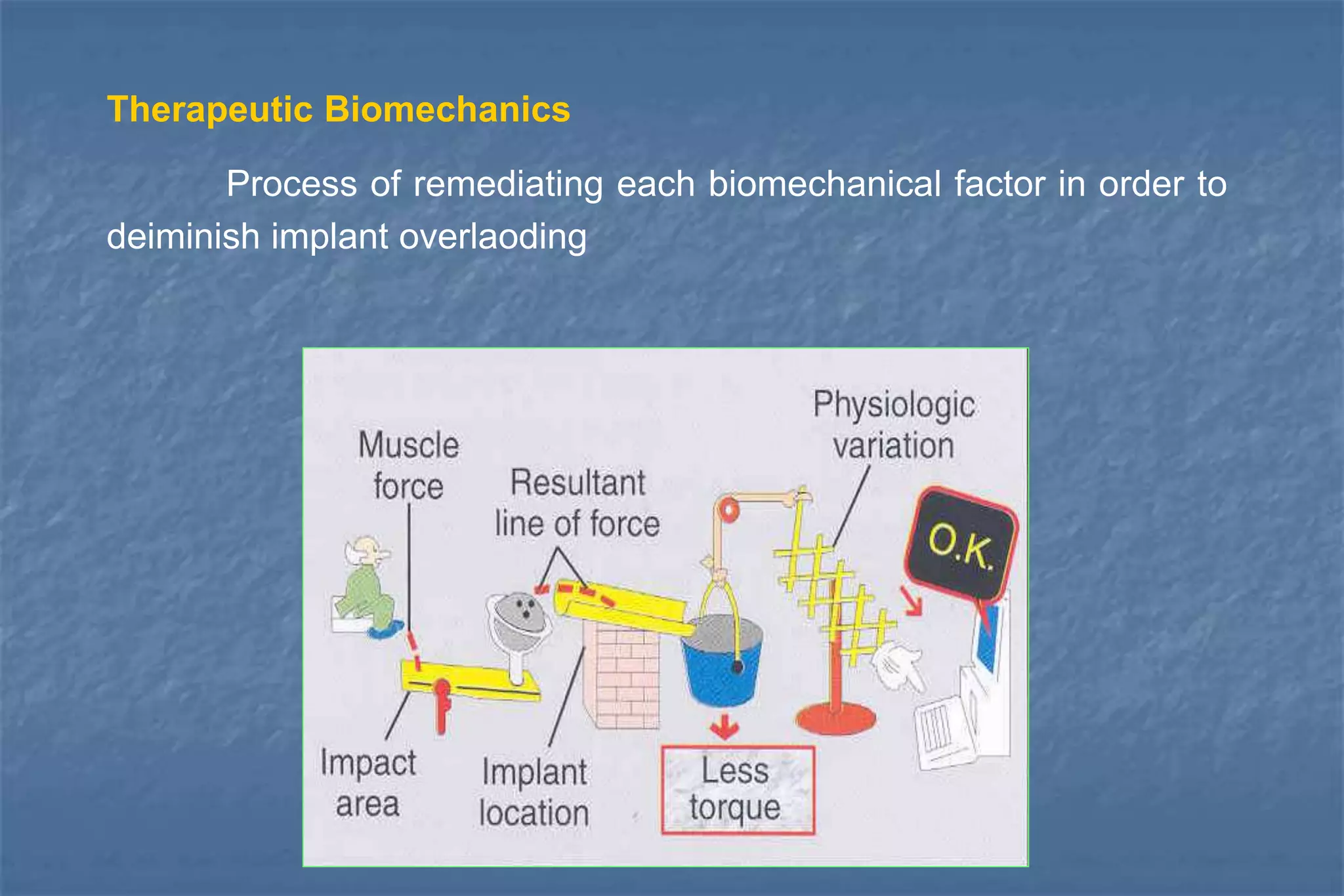 IMPLANTS-Biomechanics.ppt | Bone and Joint Conditions | Diseases and Conditions