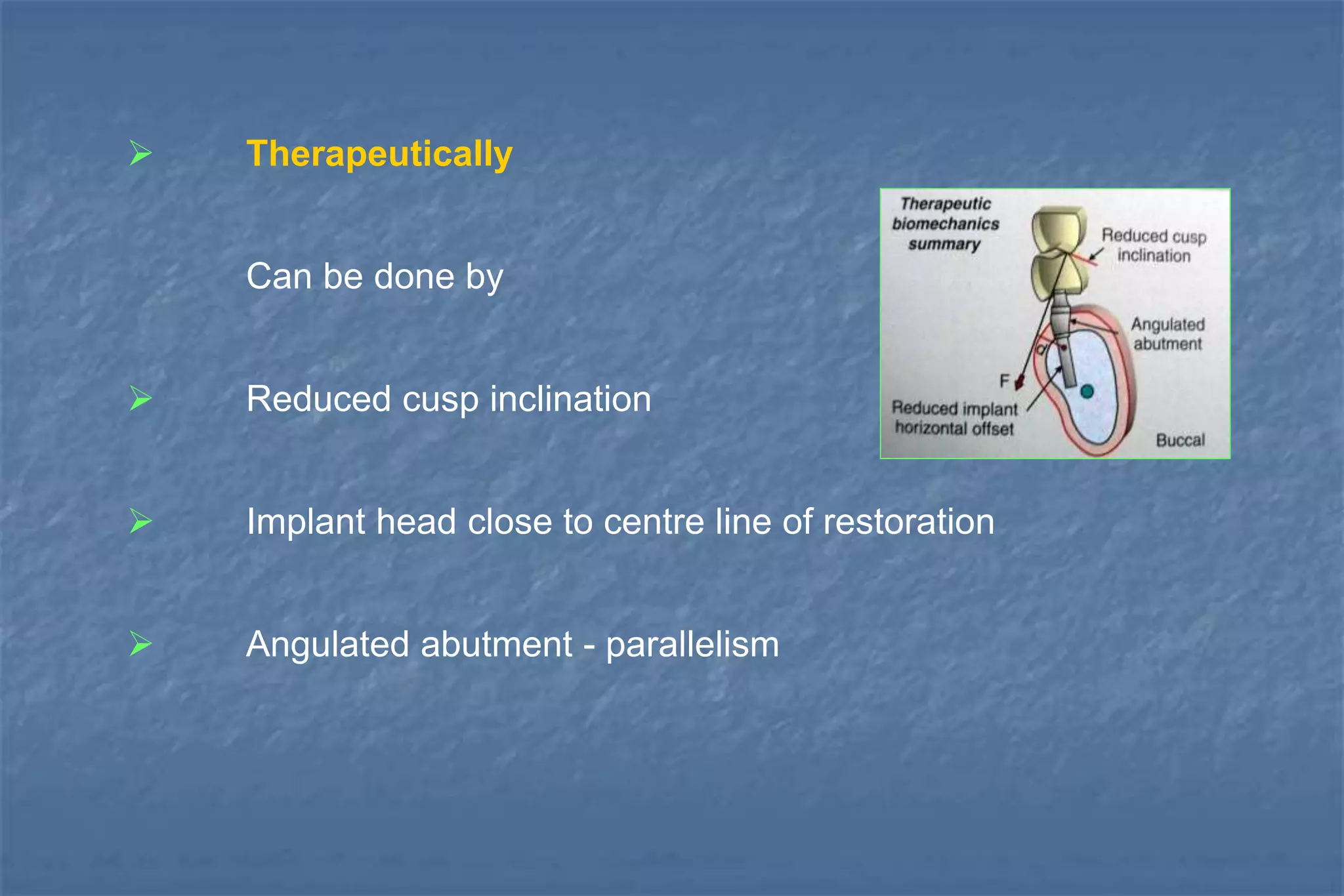 IMPLANTS-Biomechanics.ppt | Bone and Joint Conditions | Diseases and Conditions