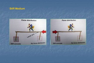 IMPLANTS-Biomechanics.ppt