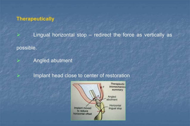 IMPLANTS-Biomechanics.ppt | Bone and Joint Conditions | Diseases and Conditions