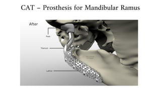 Implants and Prostheses Veterinary Sector.pdf
