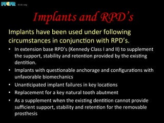 Implants and rp ds | PDF