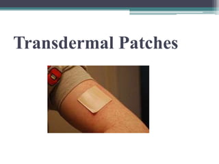 Implants and transdermal patches | PPTX