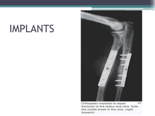 Implants and transdermal patches | PPTX