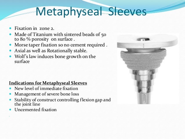 Implant Selection In Revision T.K.R