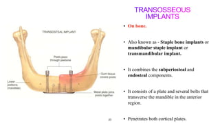 Dental IMPLANTS.pptx