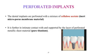 Dental IMPLANTS.pptx