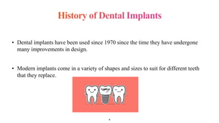 Dental IMPLANTS.pptx