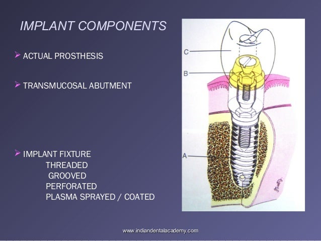 Implants in dentistry/prosthodontic courses