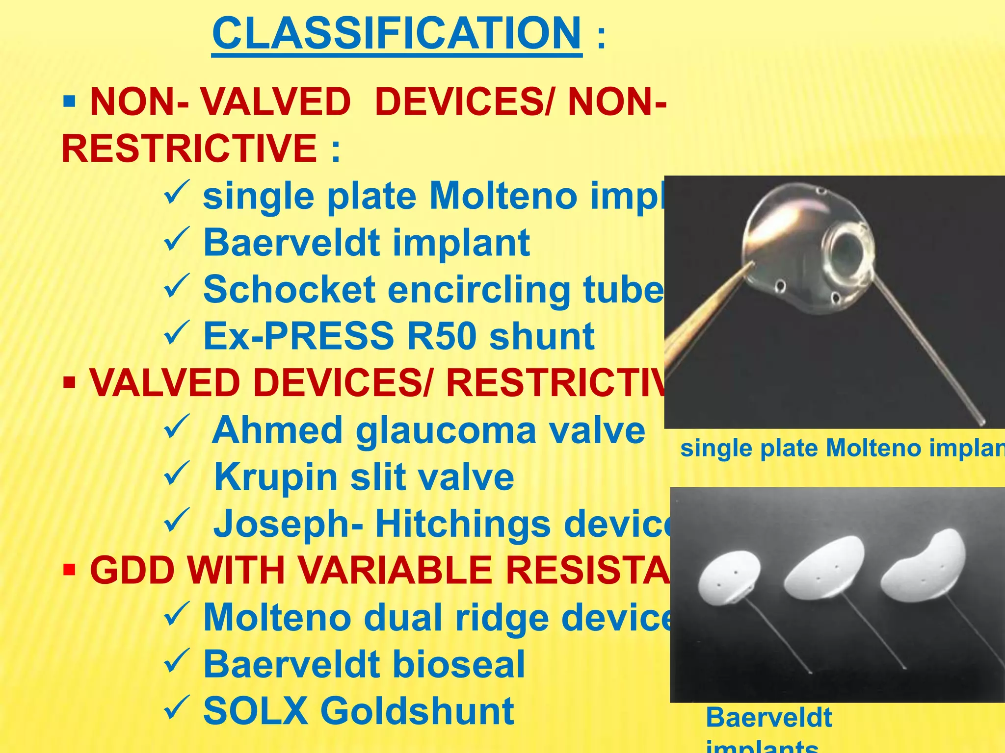 Implants in Ophthalmology | PPTX