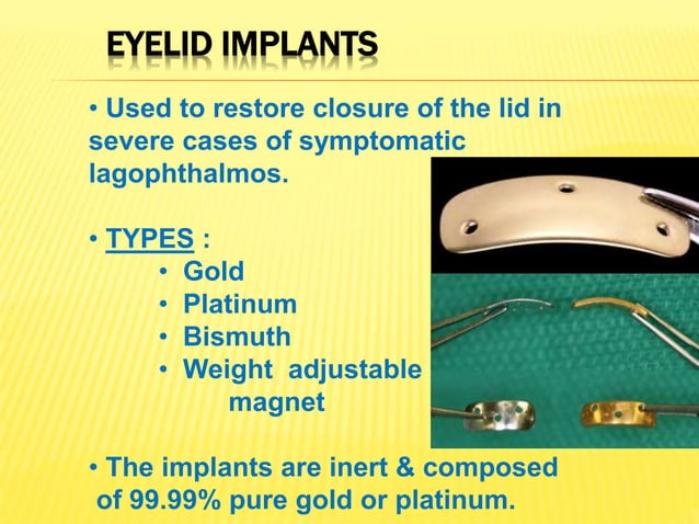Implants in Ophthalmology | PPTX | Eye and Vision Conditions | Diseases ...