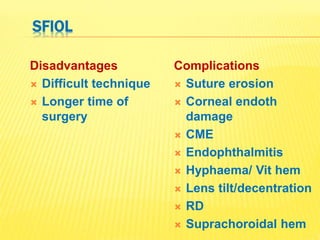 Implants in Ophthalmology | PPT