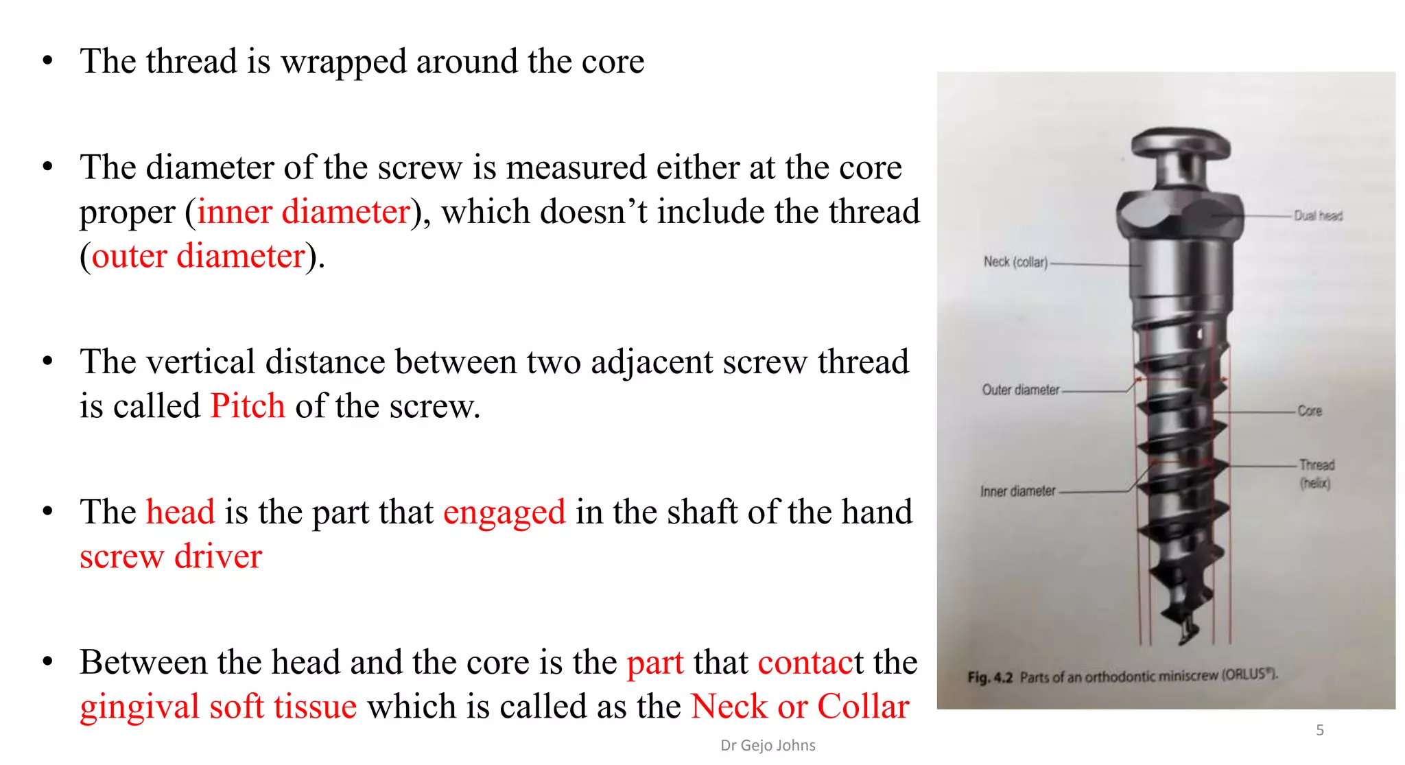 Infra-zygomatic Crest implants (IZC) | PPTX