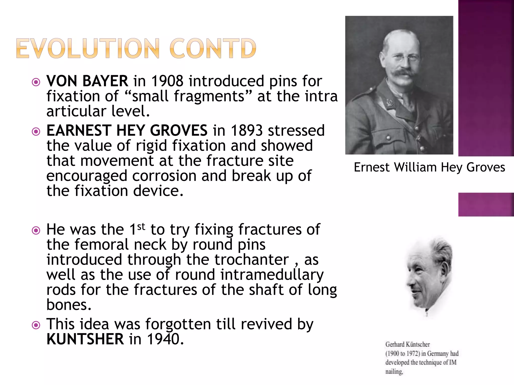 Implants in orthopaedics | PPTX