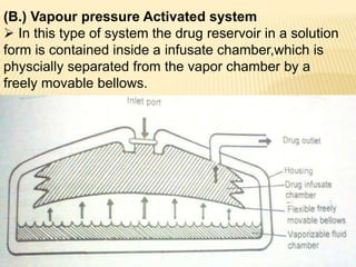 Implants & inserts ppt | PPTX