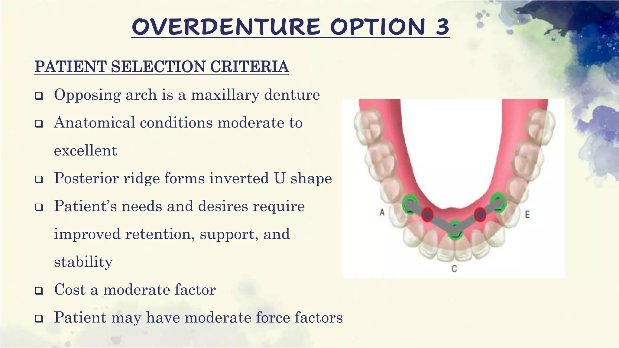 Implant supported overdenture | PPTX