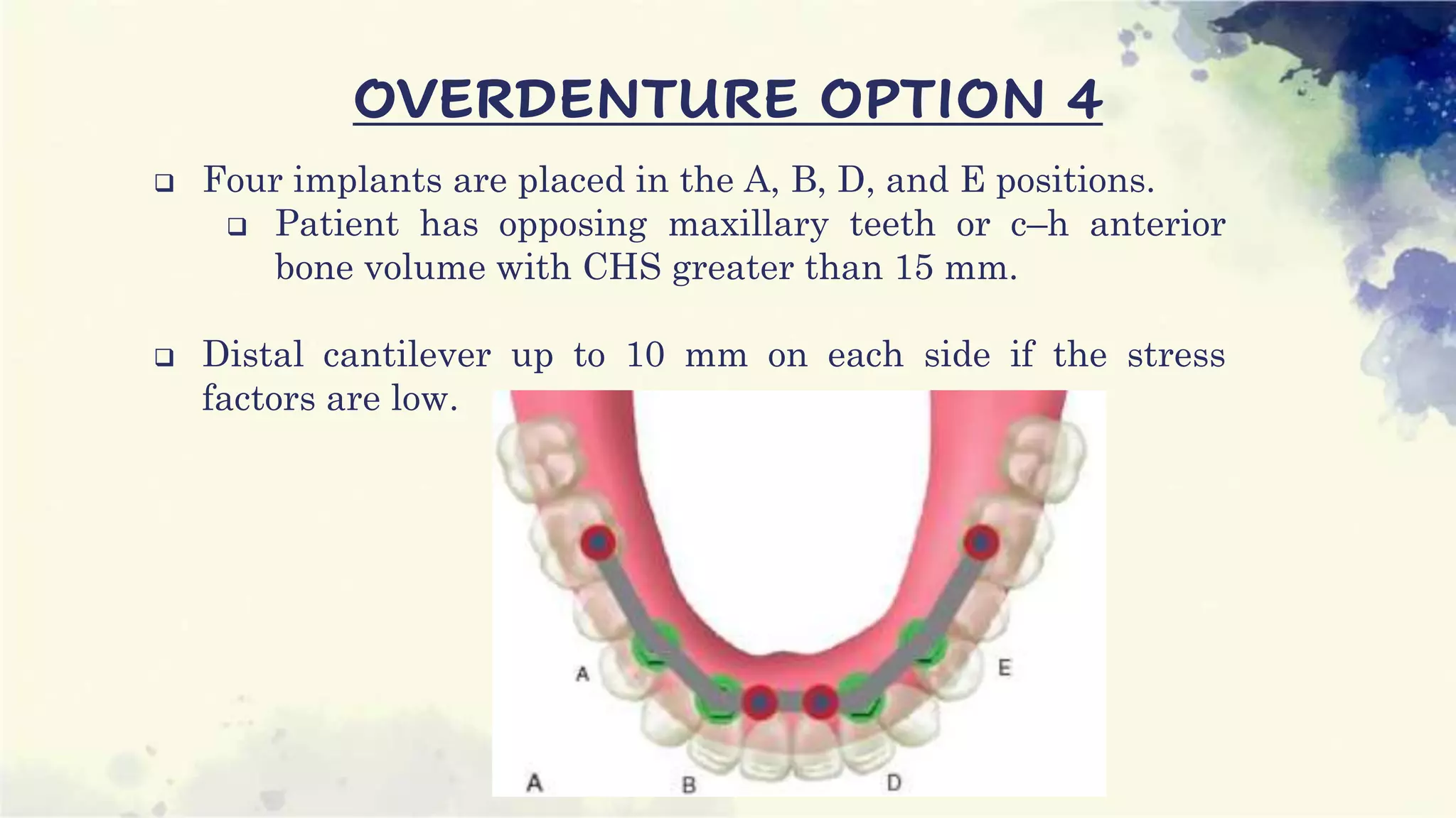 Implant supported overdenture | PPTX