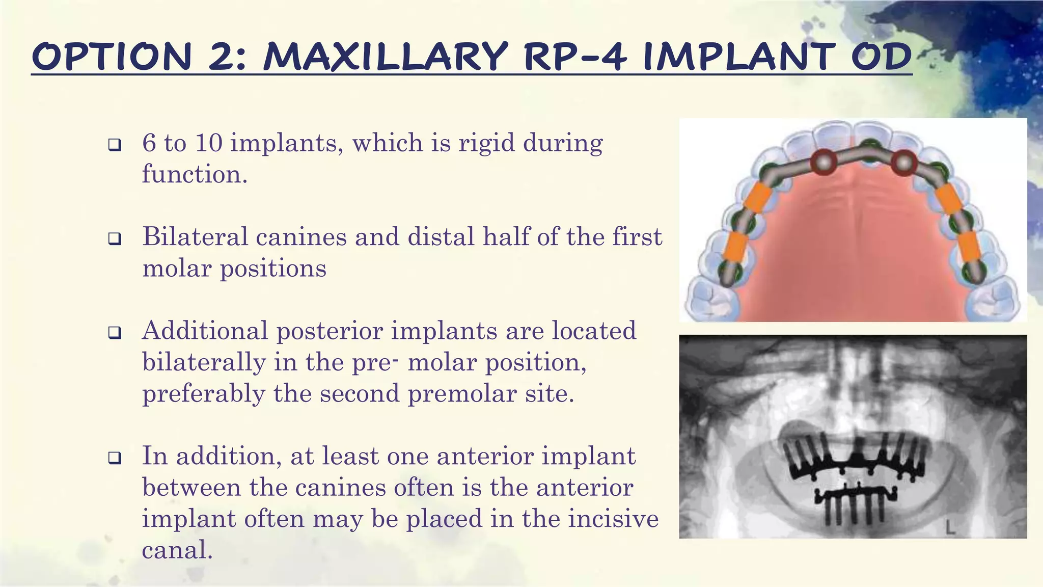 Implant supported overdenture | PPTX