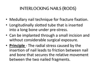 Implants (biomaterials) | PPT