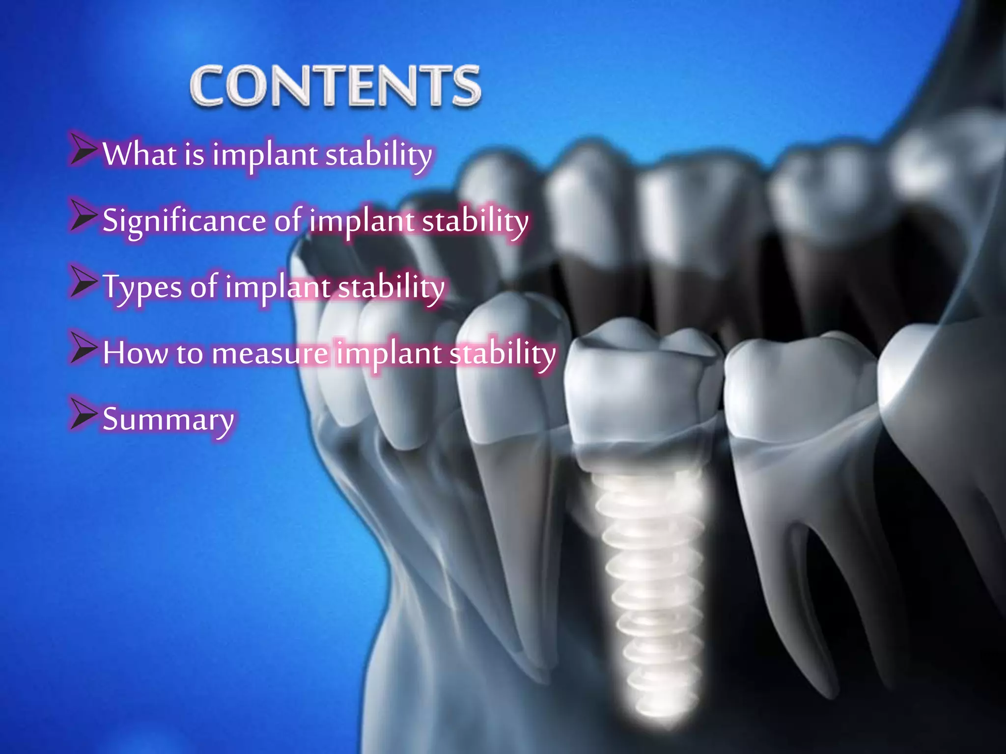 Implant stability1 | PPTX