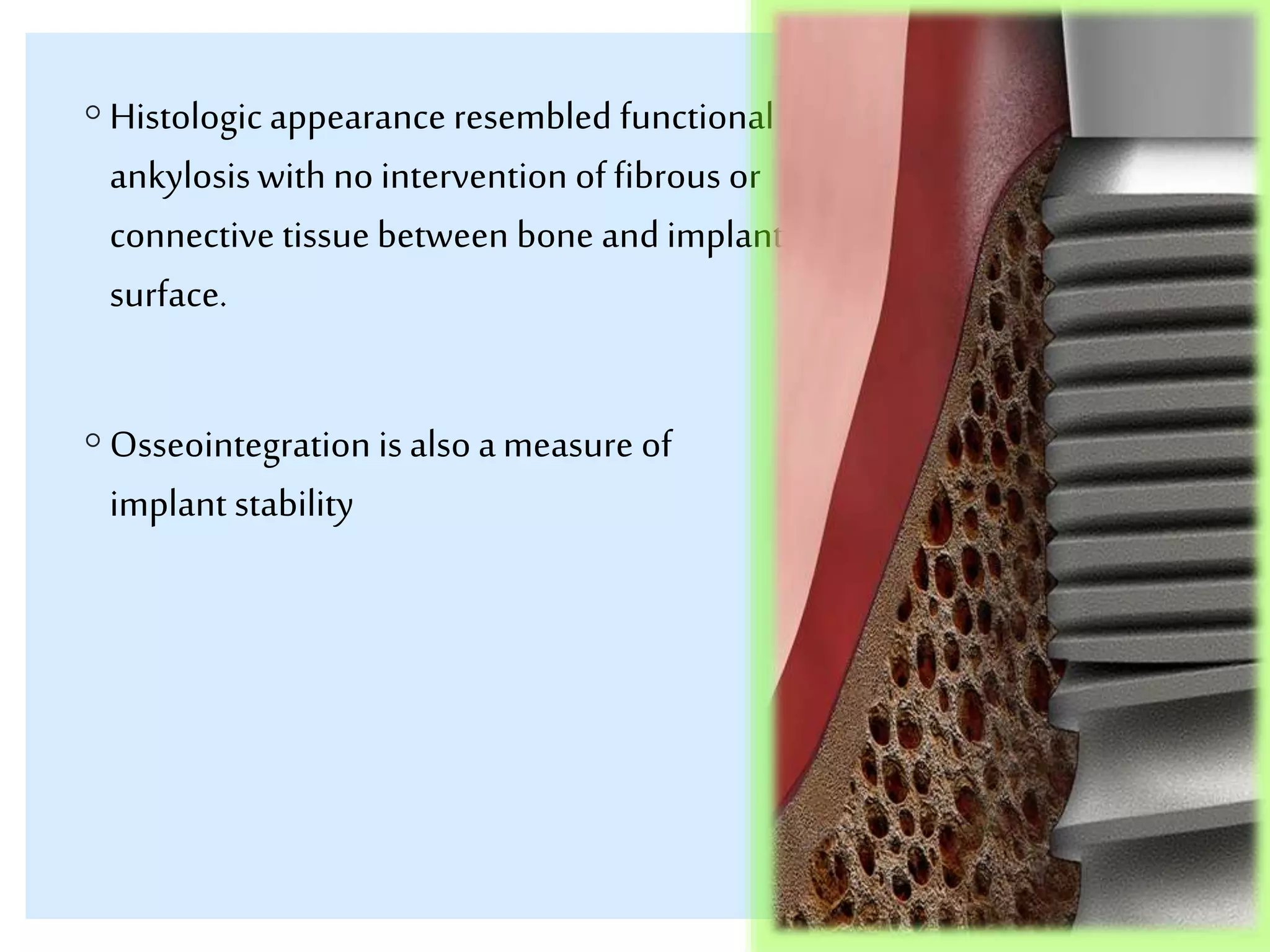 Implant stability1 | PPTX