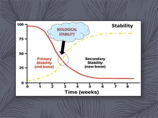 Implant stability1 | PPTX | Operating Systems | Computer Software and ...
