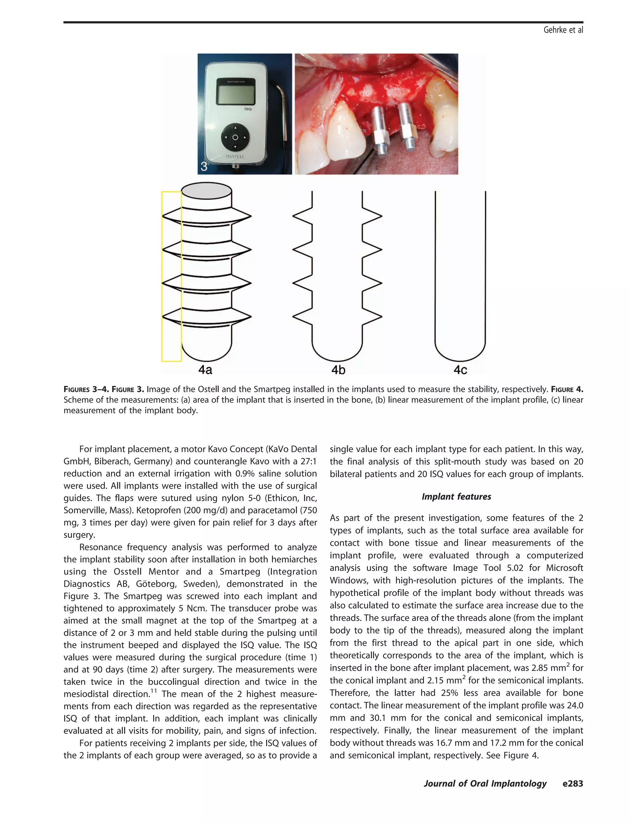 Implant stability rfa | PDF