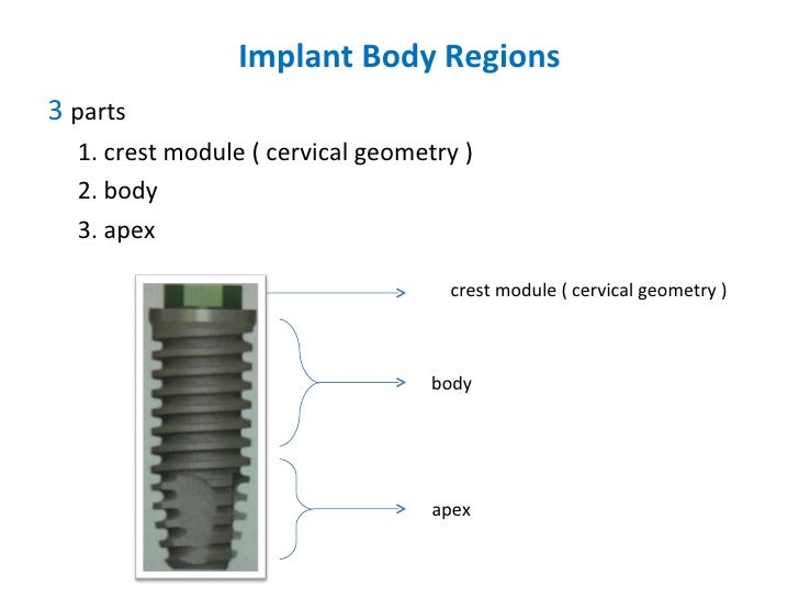 Implants the future of prosthodontics