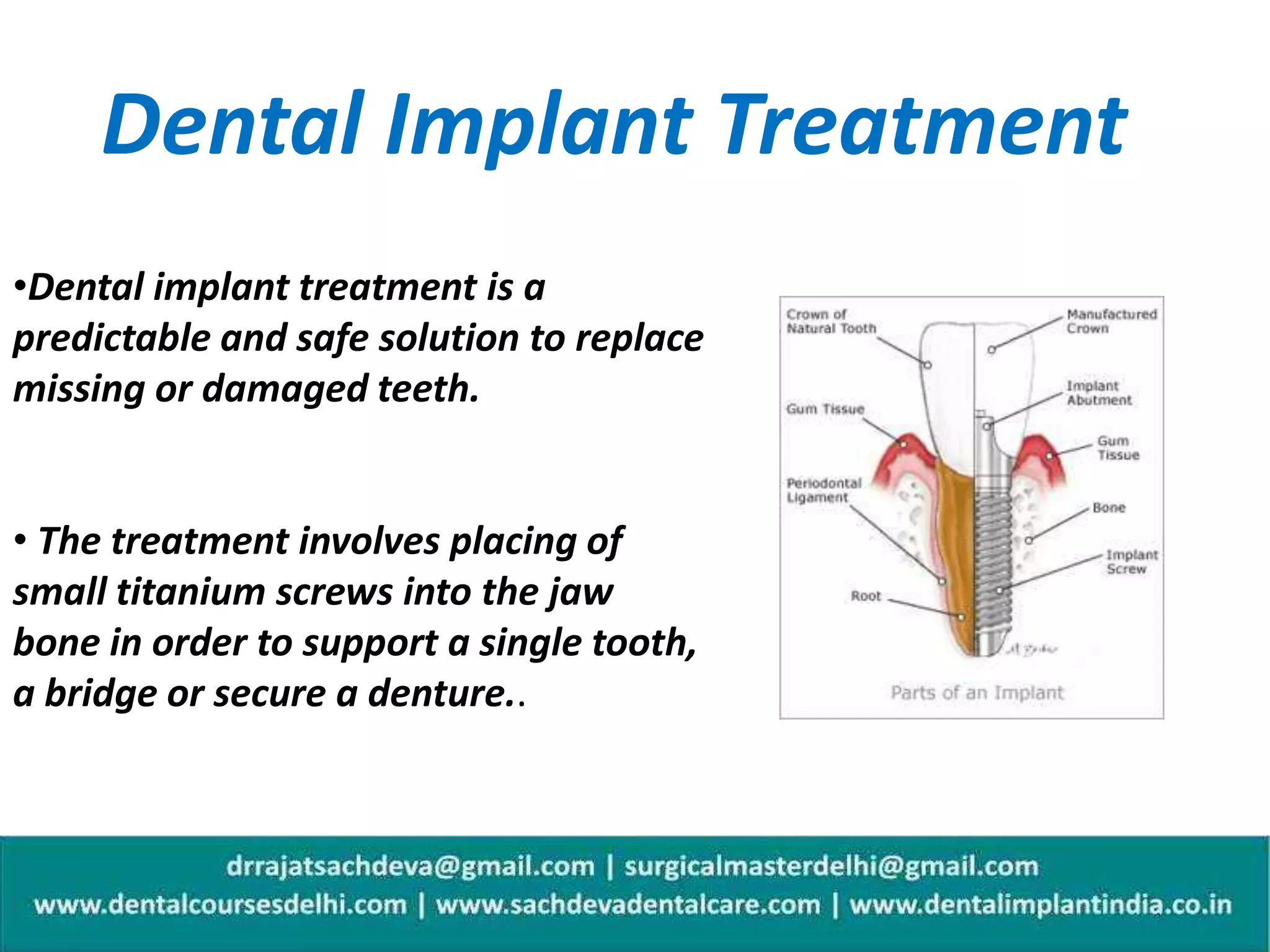 Implant success rate , all about dental implants , implant success ...