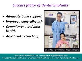 Implant success rate , all about dental implants , implant success ...