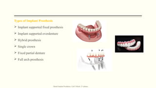 implant supported fixed prosthesis conventional versus recent advances.pptx